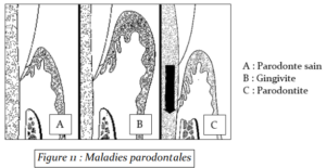 Le Parodonte / Parodontologie - CoursDentaires.com